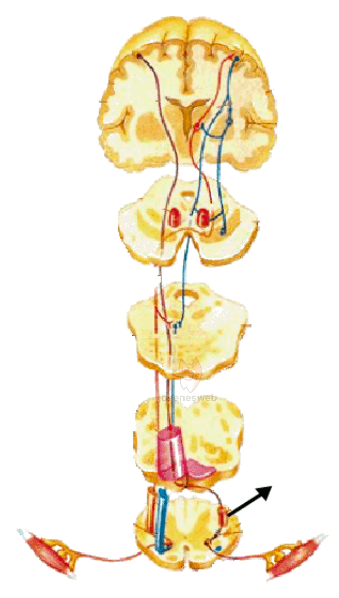 ¿Qué tracto de la vía motora voluntaria se señala en la imag ...